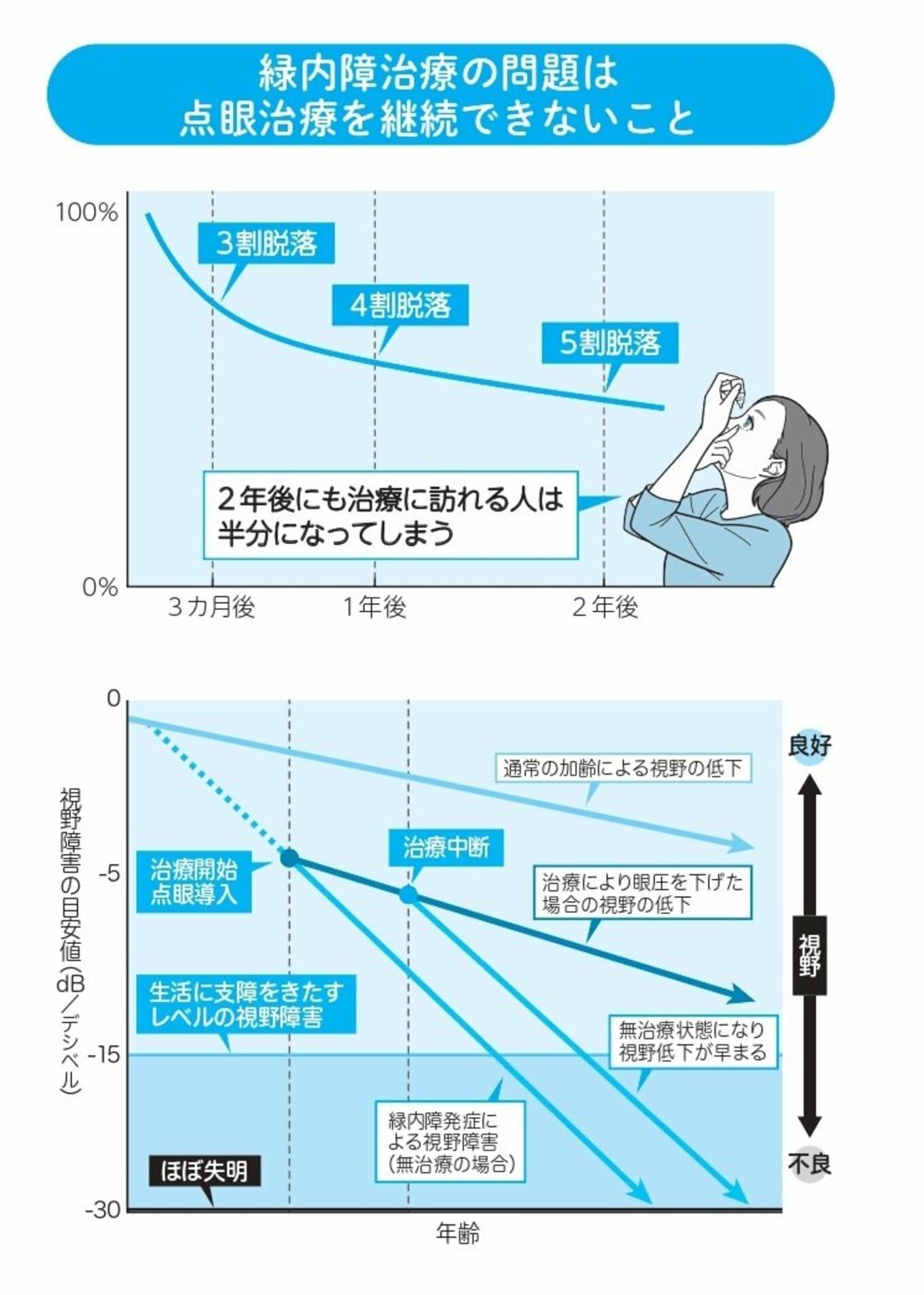 [写真](1ページ目)日本人の失明原因「緑内障」は防げる。一生目が見え続けるために守りたい4つのルール | ESSEonline（エッセ オンライン）